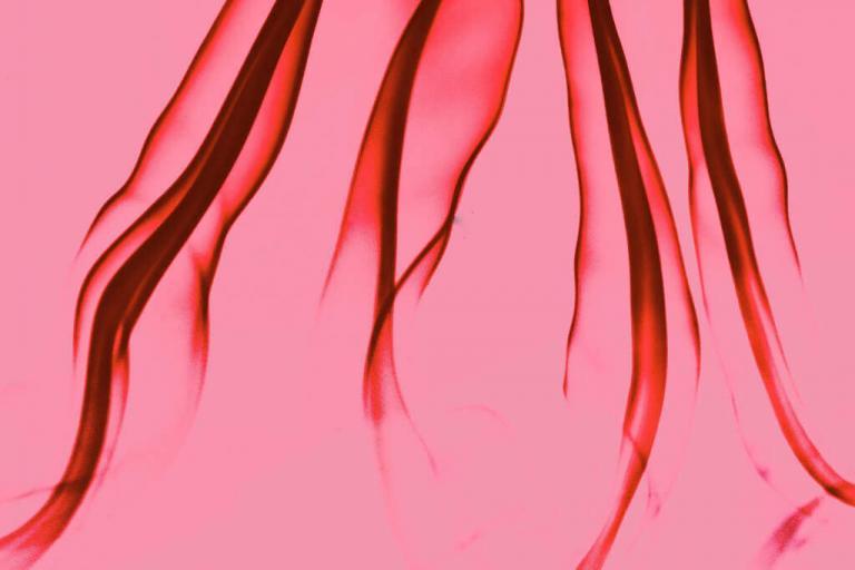 Was ist die Menstruation und wie viel Blut ist normal?